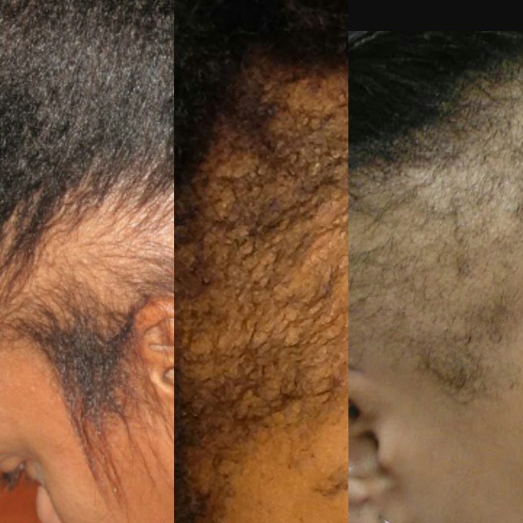 Why Weaves Damage Edges